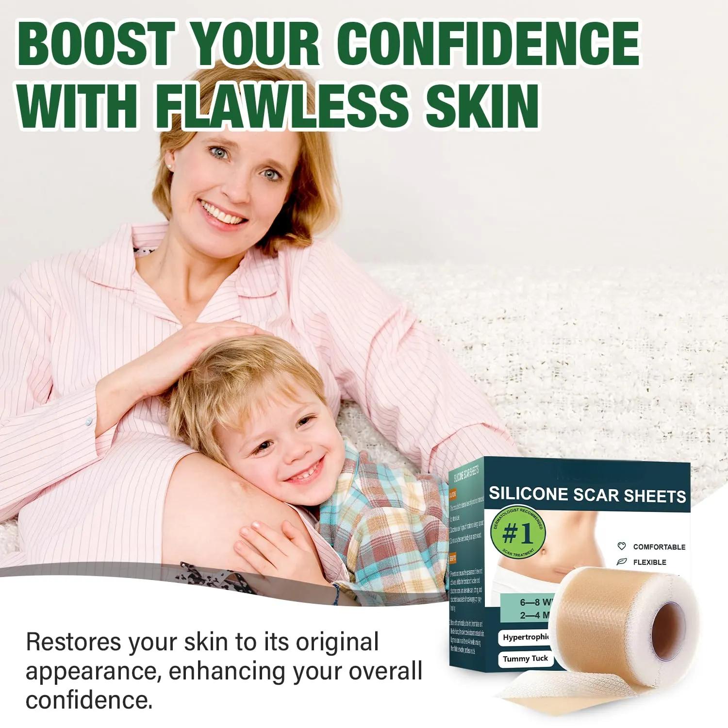 Private Label Scar Keloid Bump Removal Tape Silicone Scar Tape Sheets ...