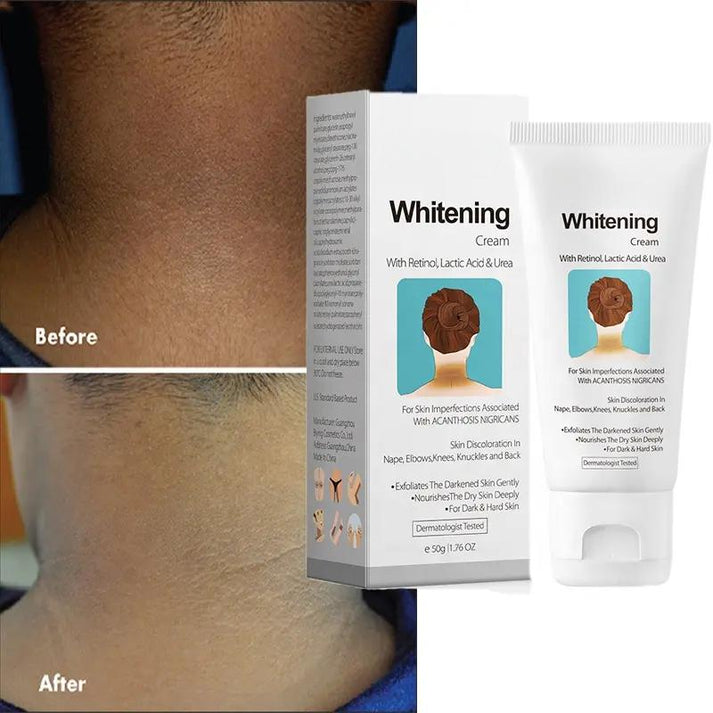 Remove Black Patches Whitening Cream Acanthosis Nigricans Knee Elbow N ...