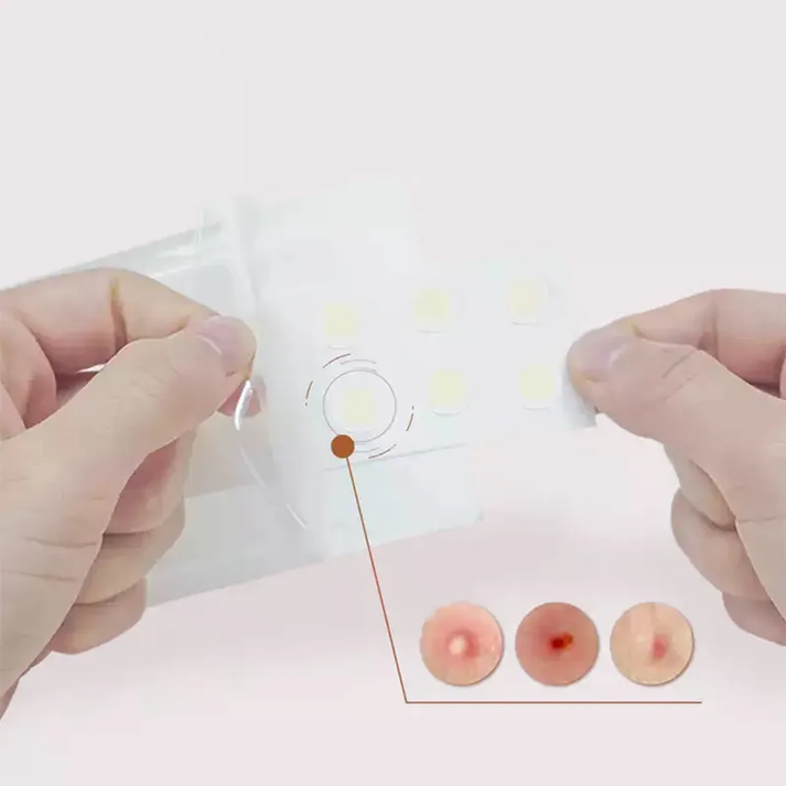 OEM & ODM Invisible Pimple Patch Factory, Salicylic Acid, Hydrocolloid ...